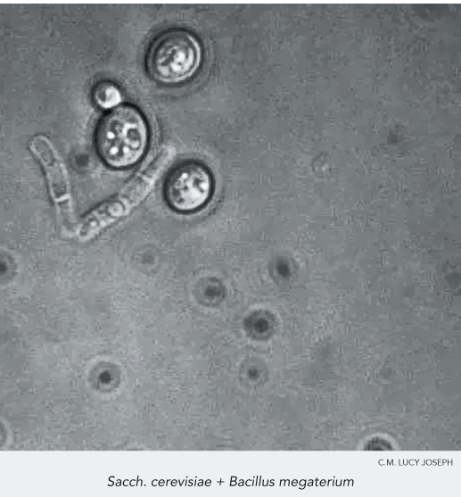 Saccharomyces Cerevisiae Under Light Microscope